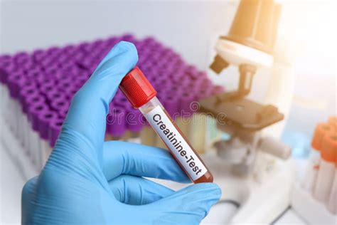 Creatinine Test From Blood Blood Samples To Be Analyzed Stock Image