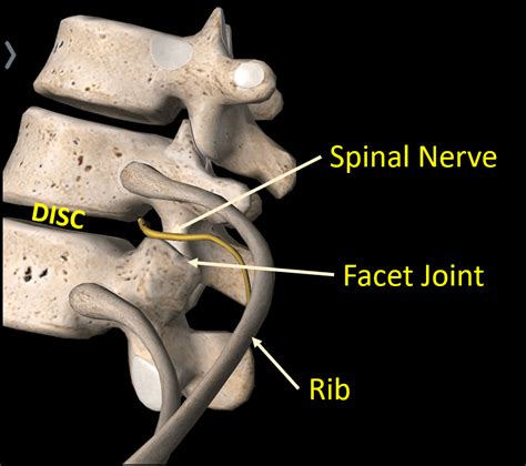 What Is Thoracic Radiculopathy Regenexx