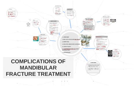 COMPLICATIONS OF MANDIBULAR FRACTURE TREATMENT By Yern Ain On Prezi