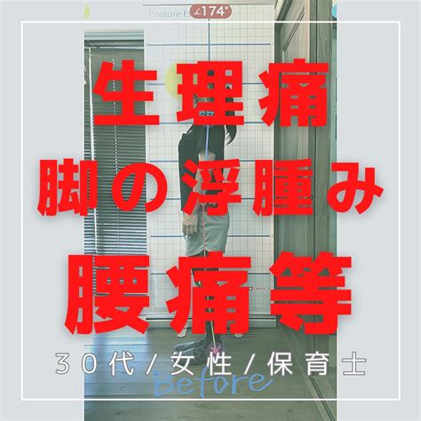 【富里 整体】腰痛、脚の浮腫み、生理痛 他 30代女性 保育 ブログ 富里で整体ならグッドカイロプラクティック