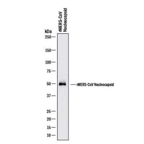 Mers Cov Nucleocapsid Antibody R D Systems 100 μg Unconjugated