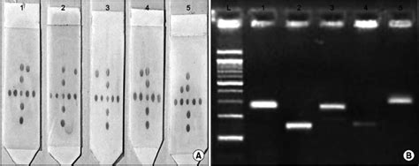 Hpv Typing By Hybridization With L1 Gene Type Specific Probe And Nested