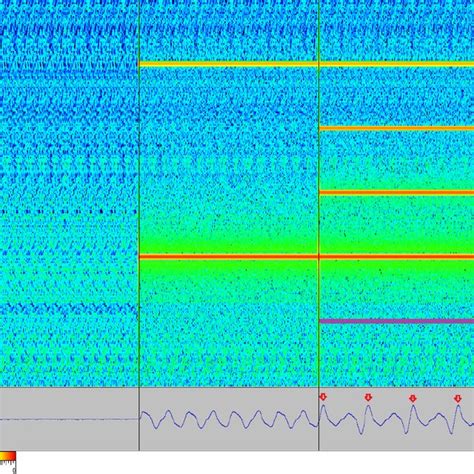 Fft Spectrograms And Waveforms For The Three Stimulus Conditions The