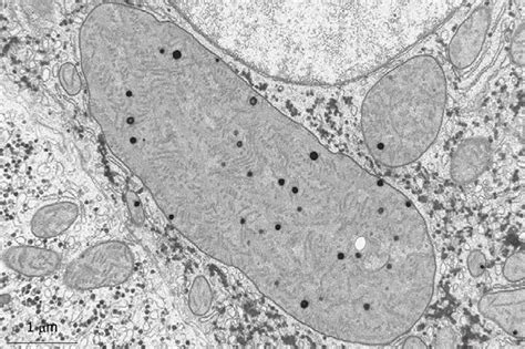 Mitochondria Electron Microscope