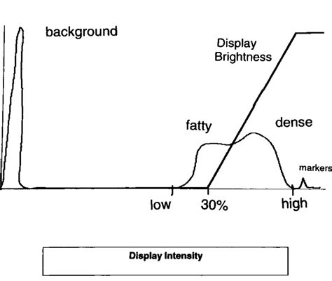 Histogram For A Digital Mammogram The Range Of Intensity Values