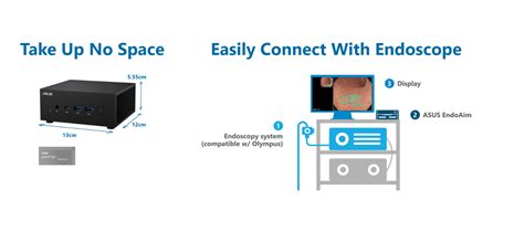 Enhancing Endoscopy Diagnostics With Ai Assistance A Pathway To Better