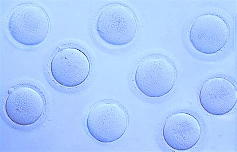 L Autoconservation De Ses Ovocytes Fiv Fr