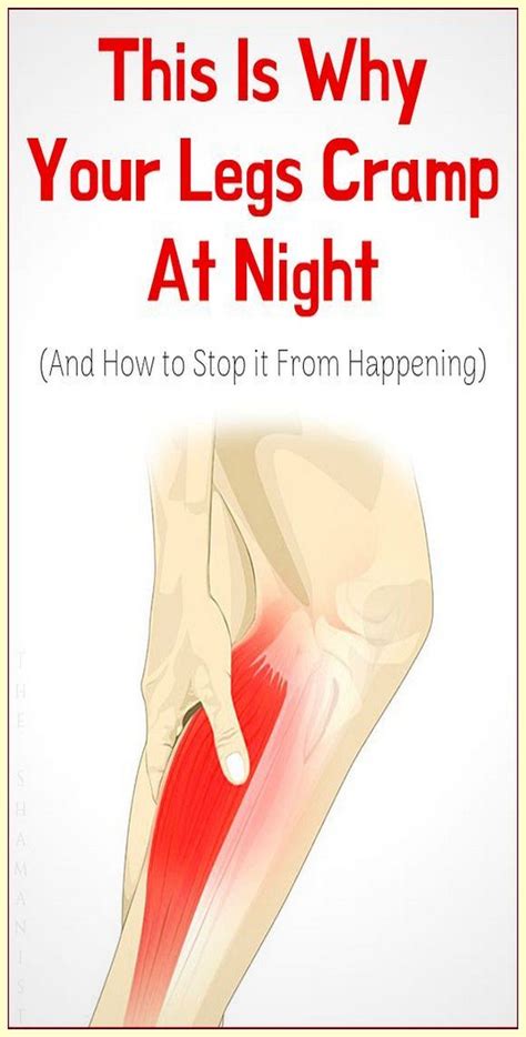 Leg Cramps At Night Causes And Remedies Artofit