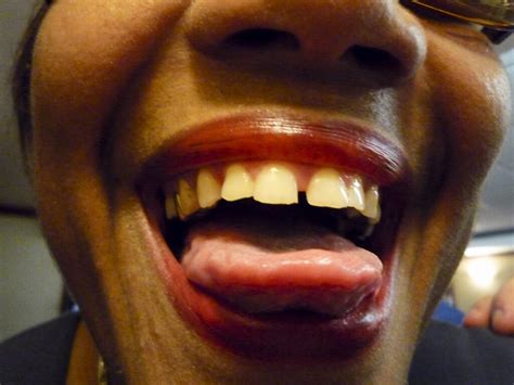 For World Aids Day Fowler Museum Looks Through Positive Eyes Los