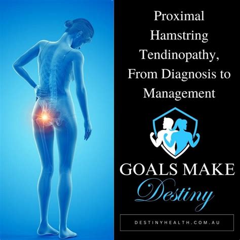 Proximal Hamstring Tendinopathy From Diagnosis To Management Destiny