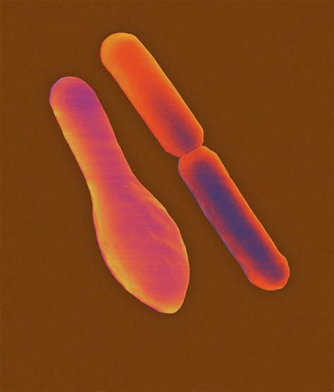 Clostridium Sporogenes Photograph By Dennis Kunkel Microscopy Science
