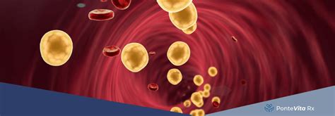 Too Young For Statins When To Start Cholesterol Meds