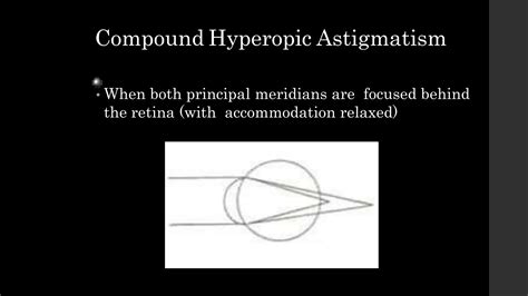Astigmatismpptx