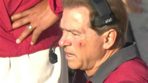 Nick Saban Is Bleeding Might Be Human After All