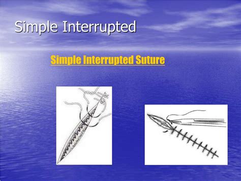PPT SUTURE MATERIALS AND TECHNIQUES PowerPoint Presentation Free Download ID 155036