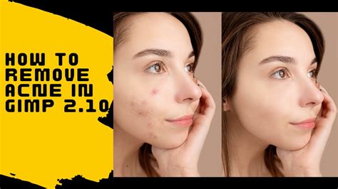 How To Remove Acne In GIMP GIMP Tutorial For Beginners GIMP Tutorial GIMP Tutorial
