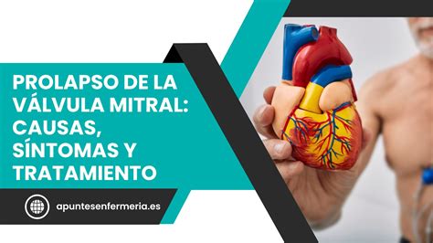 Prolapso De La Válvula Mitral Causas Síntomas Y Tratamiento Apuntes