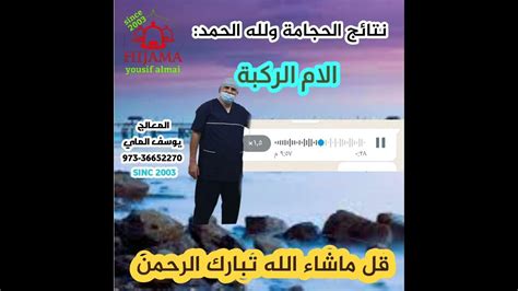 علاج الام الركبه بالحجامه الحجامه في البحرين الحجام يوسف الماي Youtube