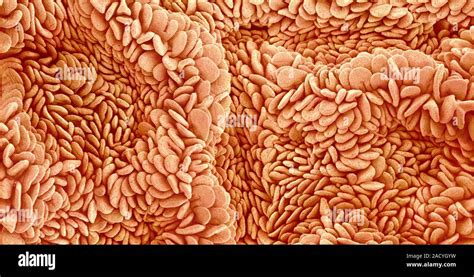 Intestinal Lining Coloured Scanning Electron Micrograph Sem Of Villi From The Small Intestine