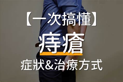 痔瘡手術 彙整 健康指南