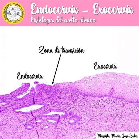 Histología Del Endocérvix