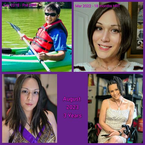 6 Months Pre Hrt 1 Year On Hrt 2 Years On Hrt And Now As Of Today 3