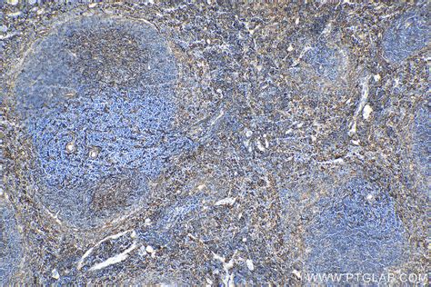 Vcam 1cd106 Antibody 30958 1 Ap Proteintech 武汉三鹰生物技术有限公司