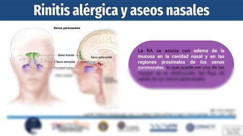 SOLUTION Eficacia De Los Aseos Nasales En La Rinitis Al Rgica Studypool