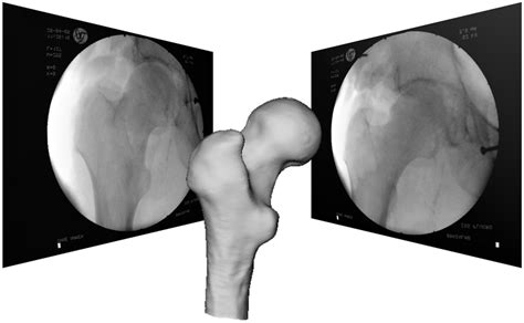 Example Of Statistical Shape Model Based 2 D 3 D Reconstruction