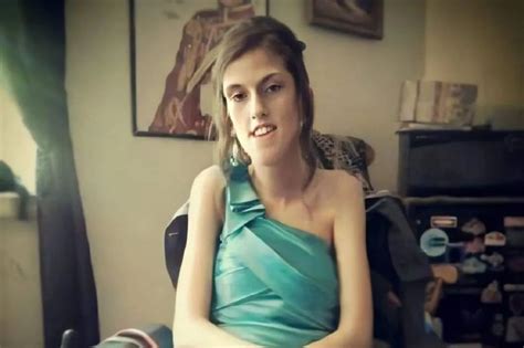 Woman With Facial Deformities Hits Back At Evil
