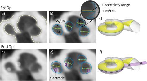 Image A Shows The Automatic Segmentation Of The Cochlea With A