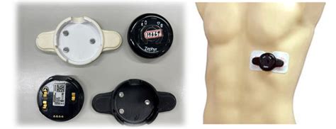 Schematic Illustration Of The Bioharness 3 0 Biopatch Device And Its