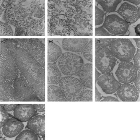 Photomicrographs Of The Epididymides Of A Control B Download