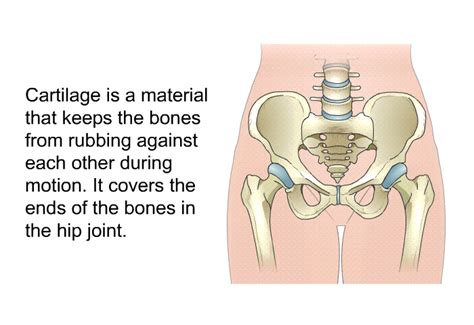 Hip Injuries And Disorders