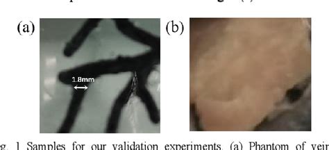 Figure 1 From Frequency Selected Adaptive Matched Filter Denoising For