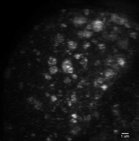 Regulation Of Rna Granule Dynamics By Phosphorylation Of Serine Rich