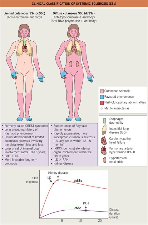 Systemic Sclerosis And Sclerodermoid Disorders Clinical Tree