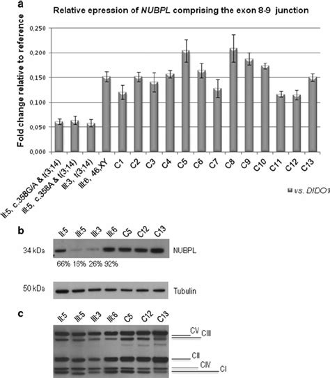 Quantification Of Nubpl Mrna And Protein In Lcls Of Translocation