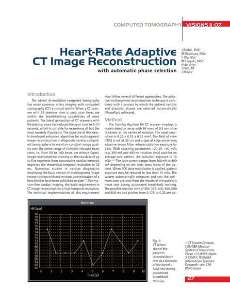 Heart Rate Adaptive Ct Image Reconstructionphasexact Download Free