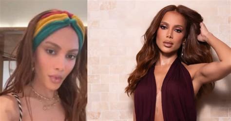 Anitta Exibe Novo Visual Após Procedimentos E Limita Comentários