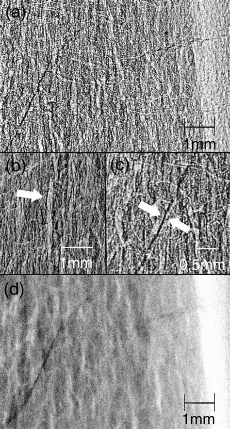 X Ray Images At The Middle Of The Rib Recorded Using Synchrotron Download Scientific Diagram