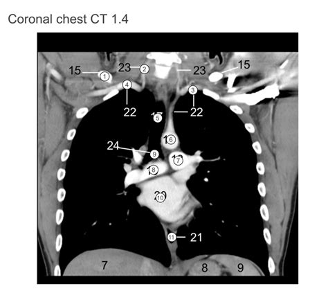 Coronal Chest Ct Diagram Quizlet