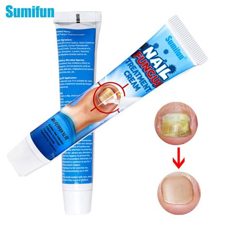 Sumifun Nail Fungus Treatment Cream Onychomycosis Removal Ointment ...