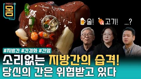 [full] 귀하신 몸 30화 좋은 간 나쁜 간 이상한 지방간 Youtube