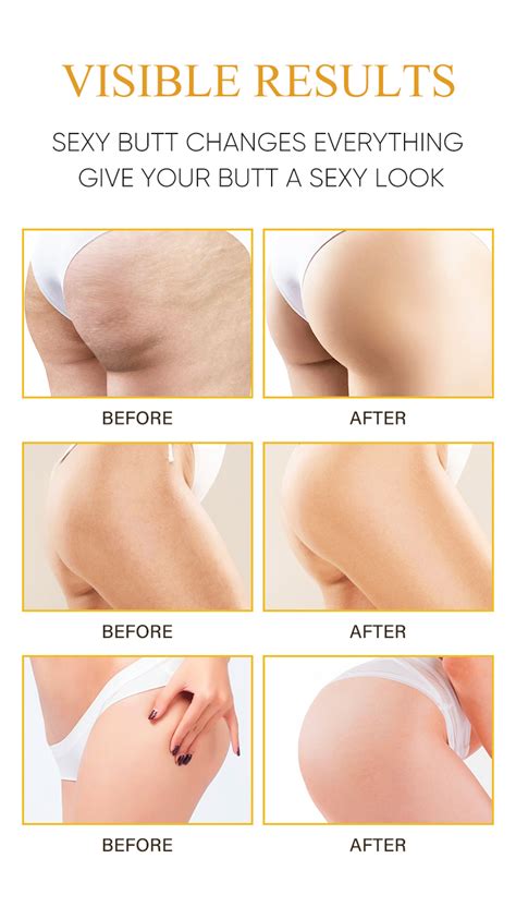 Butt Enlargement Cream Natural Growth And Firming Results