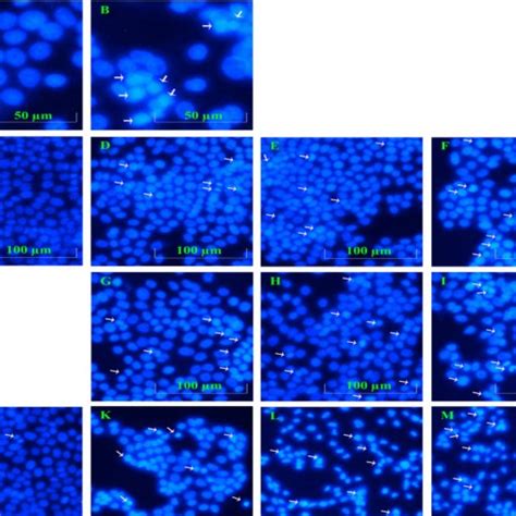 Representative Dapi Staining Of Mcf 7 Cells The Arrows Indicated The
