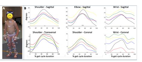 Maturation Of Arm Swing During Walking Ispgr