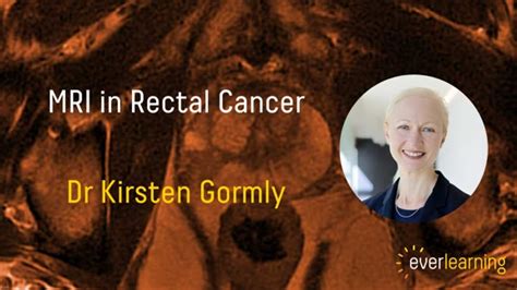 Mri In Rectal Cancer Everlearning Radiology Webinar