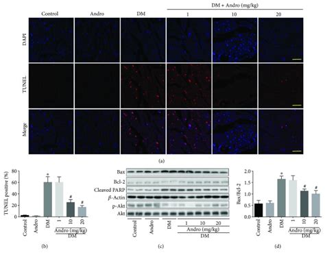 Andrographolide Ameliorates Diabetic Cardiomyopathy In Mice By Blockage