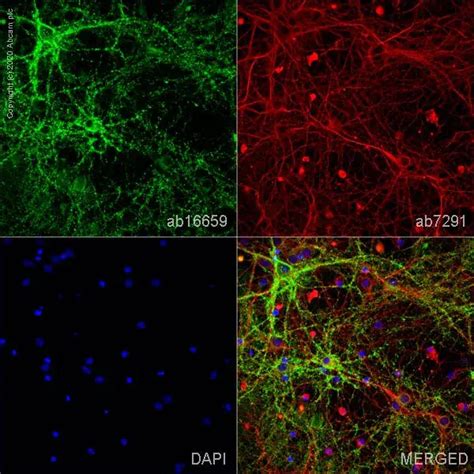 Synaptophysin抗体[sp11] Synaptic Marker Ab16659 Abcam中文官网